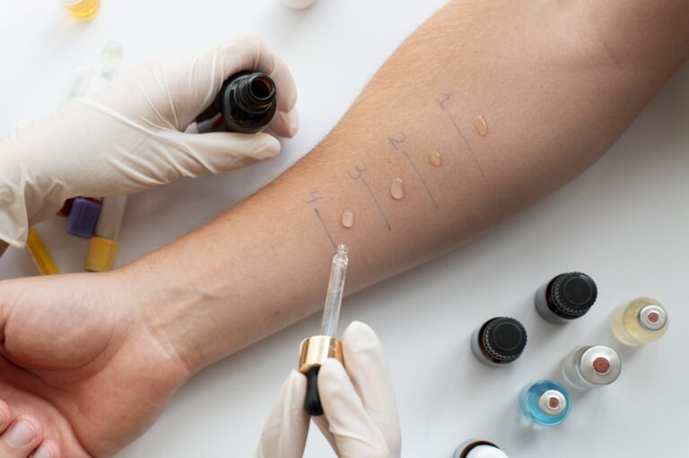 Allergy Testing – Macomb Physician